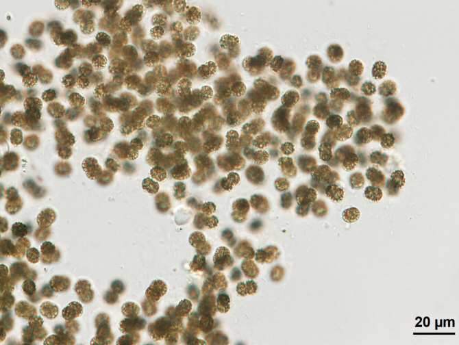 ¿Cómo captan la luz las cianobacterias? - PotenciaRadiofonicaDominicana.com